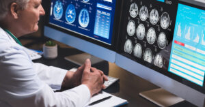 Craniectomy: A Lifesaving Neurosurgical Procedure – Docquity