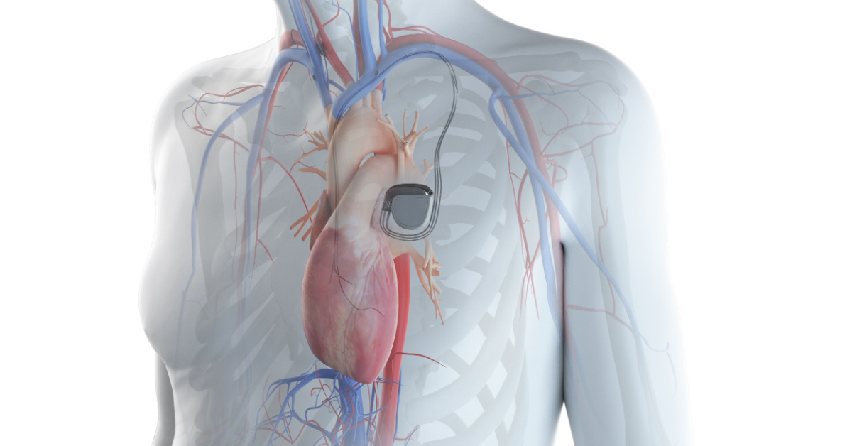 Unveiling the Extraordinary: PET Imaging Reveals Thermal Burn Resulting ...