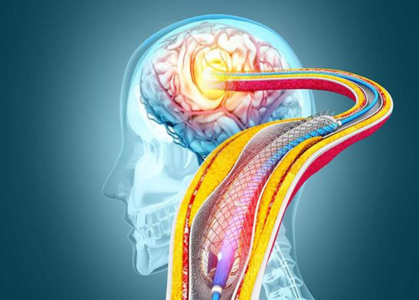 Top 11 Neuroscience Breakthroughs: Pioneering Trials