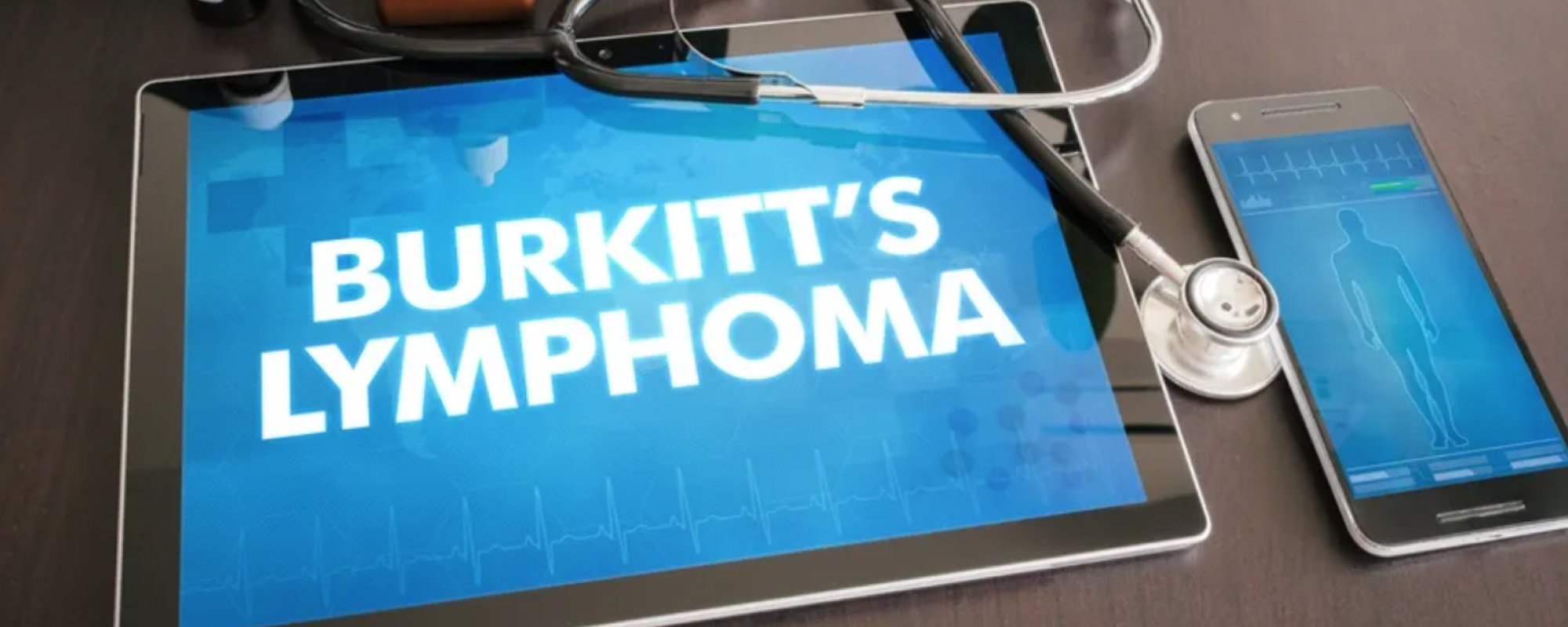 A Case of Gastric Burkitt Lymphoma in HIV/AIDS: Unusual Lymph Node ...