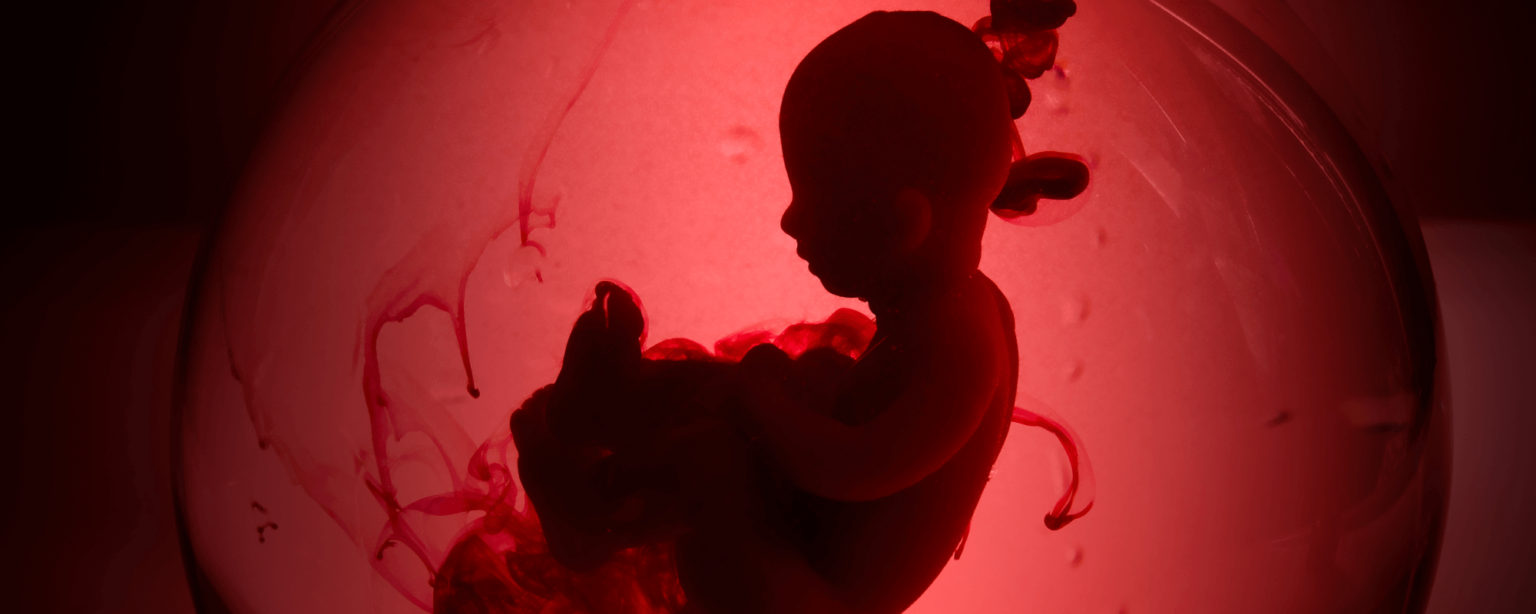 The Rare Phenomenon of Lithopedion: A Fetus Turns to Stone | 2024