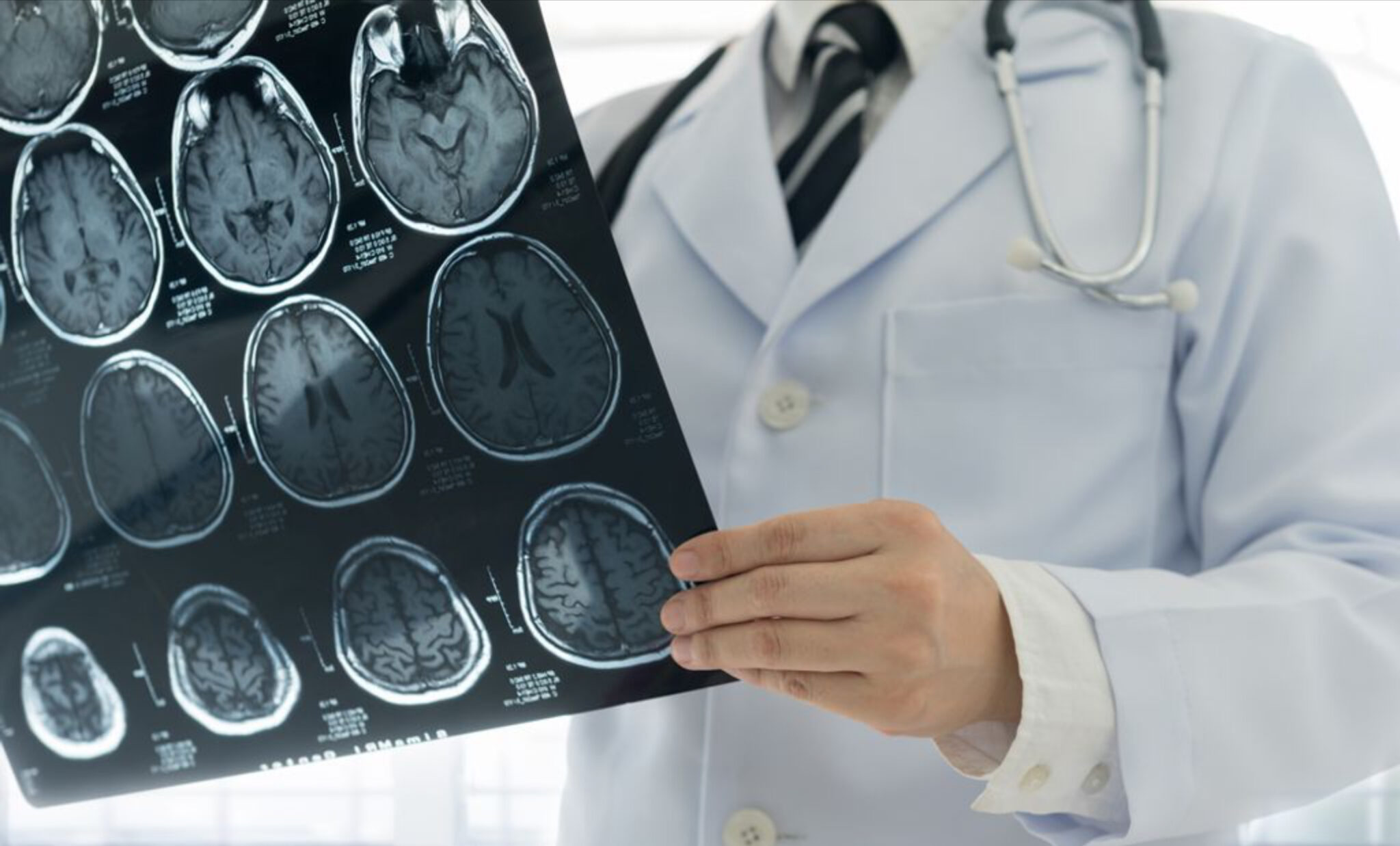 15 Things to Start Doing at 50 That’ll Save Your Brain at 80 – Docquity